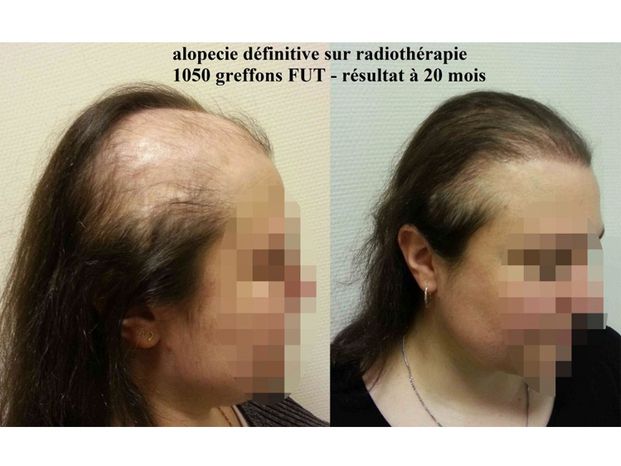 Dr Pascal Grangé - Multiesthetique.fr