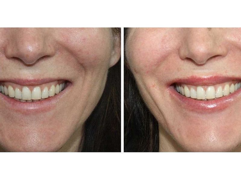 Dr Michael Atlan - Multiesthetique.fr