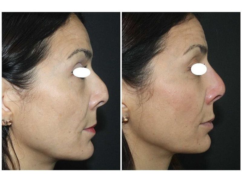 Dr Michael Atlan - Multiesthetique.fr