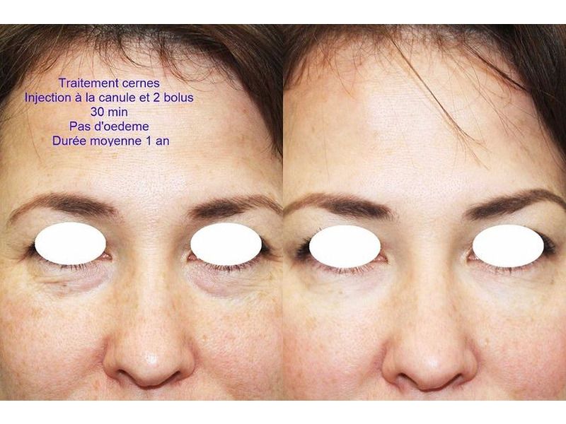 Dr Michael Atlan - Multiesthetique.fr