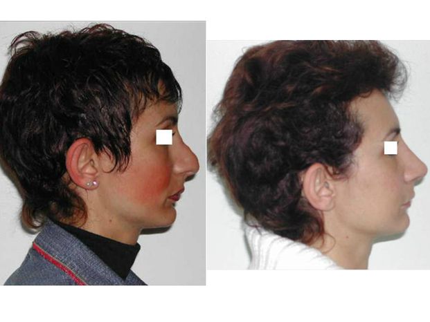 Dr Bruno Carlotti - Multiesthetique.fr