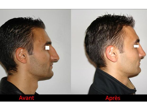 Dr Bruno Carlotti - Multiesthetique.fr