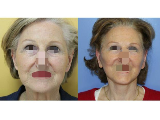 Dr Farès Belhassen - Multiesthetique.fr