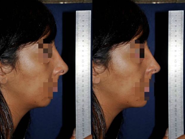 Dr Farès Belhassen - Multiesthetique.fr